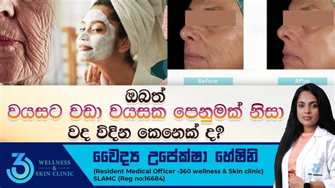 ඔබත් වයසට වඩා වයසක පෙනුමක් නිසා වද විඳින කෙනෙක්ද Youtube