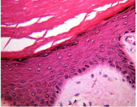 Stratified Squamous Keratinized Epithelium Quiz
