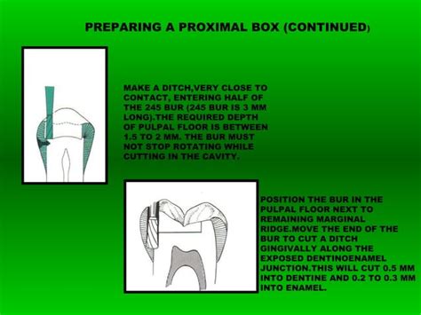 Class Ii Amalgam Preparation Ppt