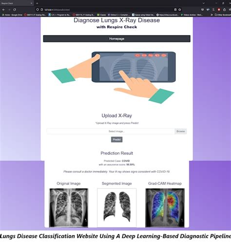 Build Deep Learning Solutions For Object Detection Image