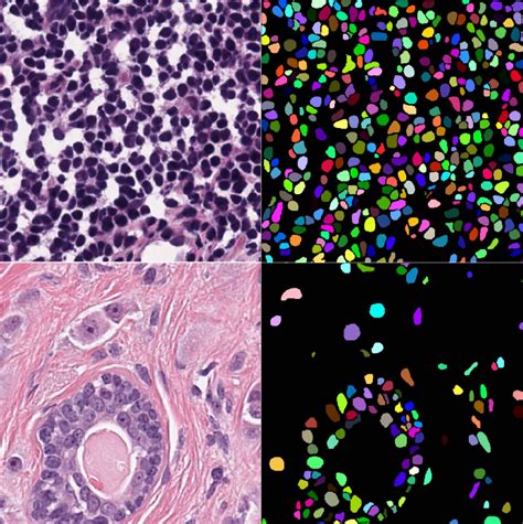 Figure 2 From Segmentation Of Nuclei In Histopathology Images By Deep