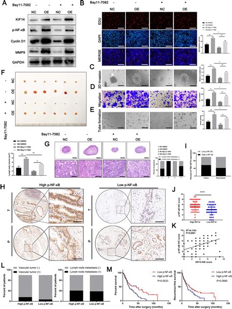 Kif14 Facilitated Cca Development In Nf κb Pathway Dependent Manner A