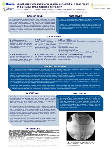 Pdf Spinal Cord Stimulation For Refractory Pericarditis A Case