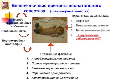 Пороки развития и заболевания желчных протоков и желчного пузыря у детей
