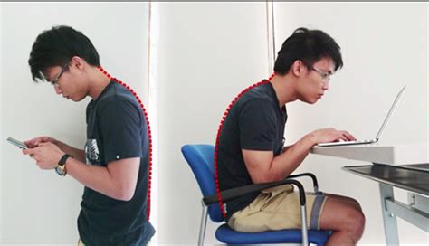 Human Posture Monitoring Using Flex Sensor Arduino Biomedical Project