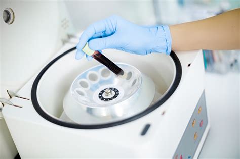 Plasmolifting입니다 주사에 대 한 혈액의 준비입니다 미용사는 원심 분리기에 혈액의 튜브를 박 았 Stem 주제에 대한 스톡 사진 및 기타 이미지 Istock