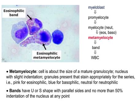 Eosinophilic Band