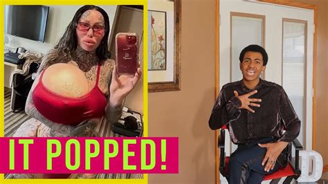 This Influencers Breast Implant Popped Youtube