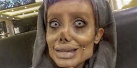 Ihre Fotos Schockten Drama Um „zombie Angelina“ Jetzt Soll Die Echte Jolie Helfen Mopo