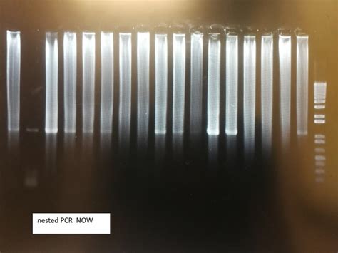Questions With Answers In NESTED PCR Scientific Method