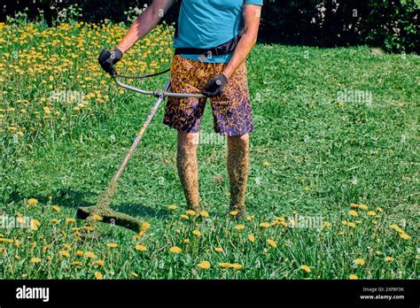 As Result Of Using Weed Whacker Gardener Exposed Skin Legs Is Covered