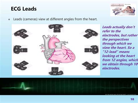 Basics Of Electrocardiographypptx