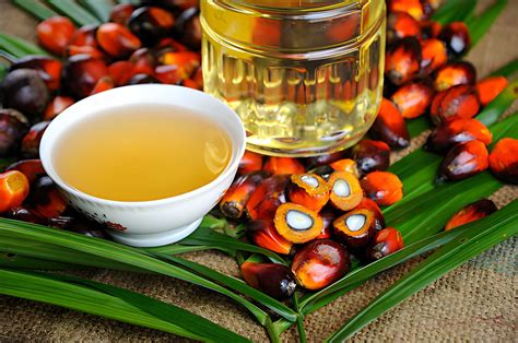 15 Best Home Remedies For Dandruff To Get Rid Of Flakes Naturally