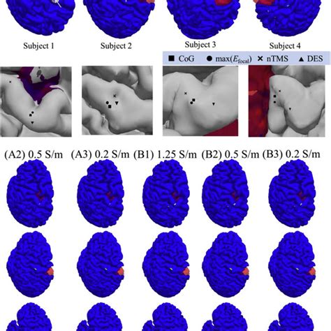 Tms Mapping Verification On A Non Affected Hemisphere A1 B1 Average