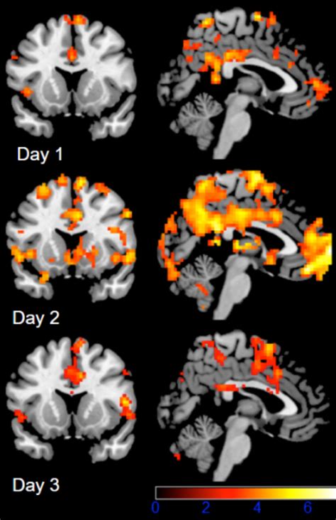 Reasons Not To Have Sex Before Fmri Experiments The Phdrawer