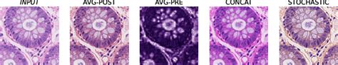 Multi Target Stain Normalization For Histology Slides