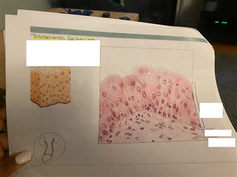 Transitional Epithelium Diagram Quizlet