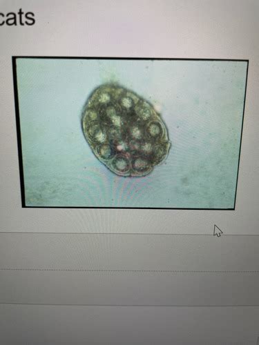 Final Clin Path Lab Flashcards Quizlet