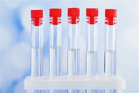 Cerebrospinal Fluid Biomarkers For Neurological Diseases
