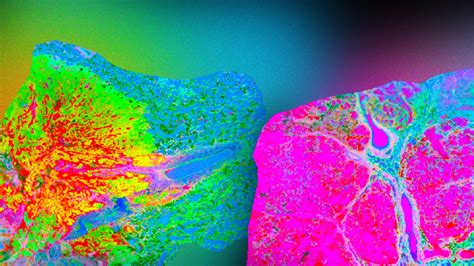 Labcast More Insight Per Pixel In Spatial Biology Applications Using