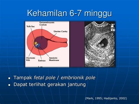 Usg Dasar Dalam Kehamilan