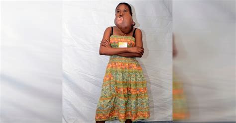 Мир Тайн Огромная опухоль на лице девушки