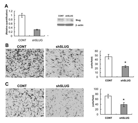 Knockdown Of Endogenous Snai2slug Decreases Glioblastoma Migration And
