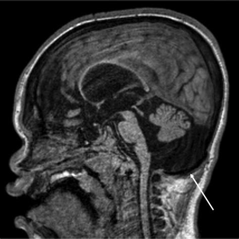 Sagittal T1‐weighted Volumetric Acquisition Demonstrating Different Download Scientific Diagram