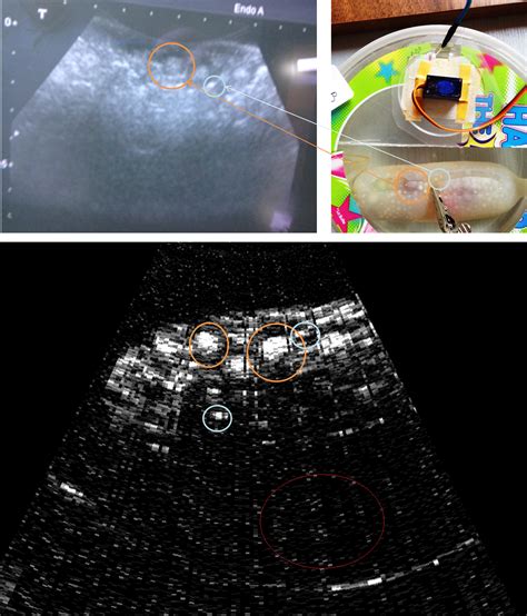 getting usable images with a 500 diy ultrasound machine details
