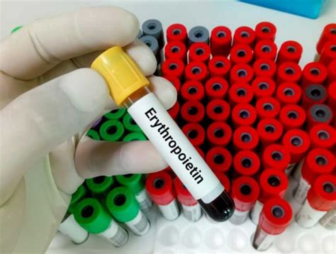 Eritropoietin Hormon Yang Mengatur Produksi Sel Darah Merah