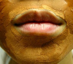 Homemade Facial Mask For Oily Skin How To Get Rid Of Oily Skin