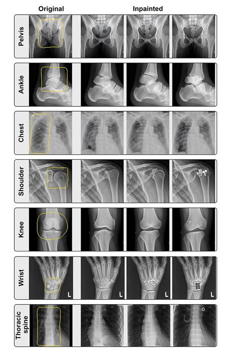 can ai image generator dall e 2 advance radiology healthcare in