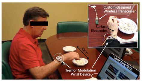 Wearable Neuromodulation