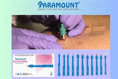Biopsy Punch Tool Uses In Essential Tissue Sampling Paramount Surgimed Ltd
