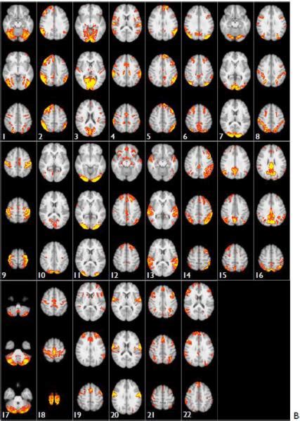 Resting State Fmri In The Human Connectome Project Pmc