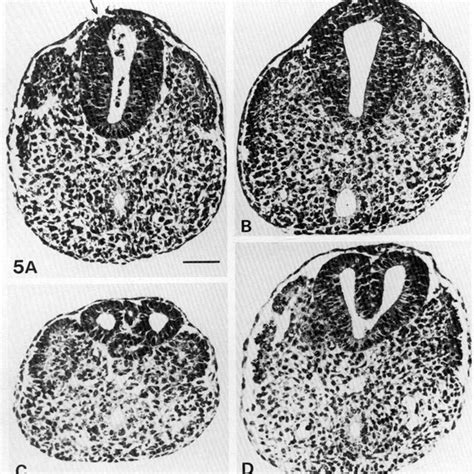 Whole Rat Embryos After 48 H Of Culture With Extraembryonic Membranes Download Scientific