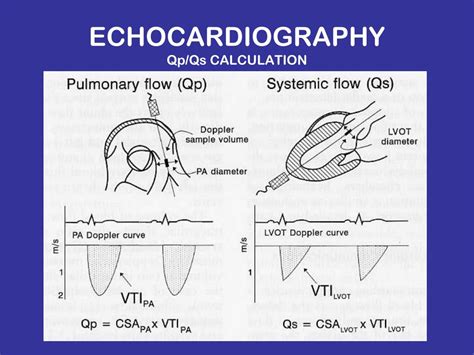 Qp Qs Pda Echo At David Trumper Blog