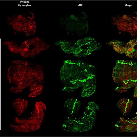 Whole Cleared Pswat Depots Reveal Widespread Rtta Independent Tre Cre Download Scientific