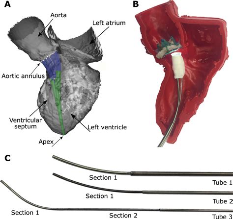 Catheter Robotics At Terry Camacho Blog