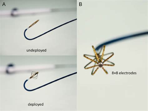 The Novel Multielectrode Mini Basket Catheter This Catheter Has An 8 F Download Scientific