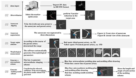 Computer Assisted Microcatheter Shaping For Intracranial Aneurysm