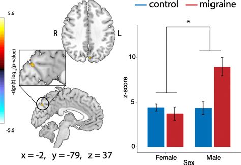 Group By Sex Interaction Effects On Connectivity Cluster In The
