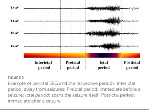 Figure 2 From The Performance Evaluation Of The State Of The Art Eeg
