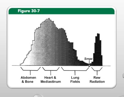 CR Imaging Preprocessing Terms Definitions For CS Babes Flashcards Quizlet