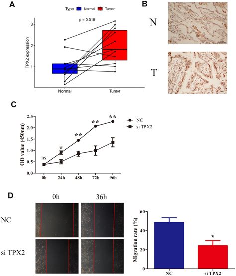 Integrative Analysis Confirms Tpx2 As A Novel Biomarker For Clinical Implication Tumor