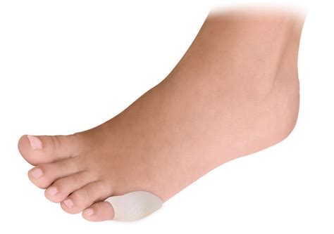 Ортопедичен Магазин Грижа за краката