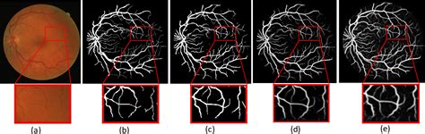 Figure 9 From Multi Scale And Multi Branch Convolutional Neural Network