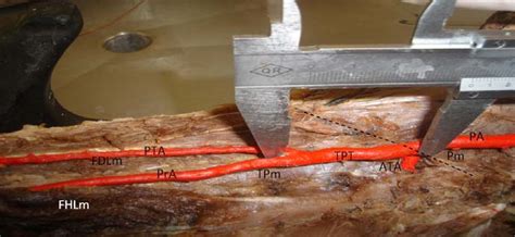 This Photograph Shows The Measurement Of The Tibioperoneal Trunk Is Download Scientific Diagram