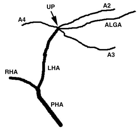 Accessory Hepatic Artery