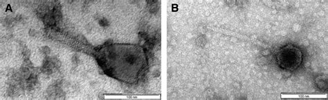 Novel Escherichia Coli Infecting Bacteriophages Isolated From Uganda That Target Human Clinical